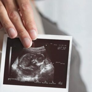 tanda awal mengandung 1 minggu